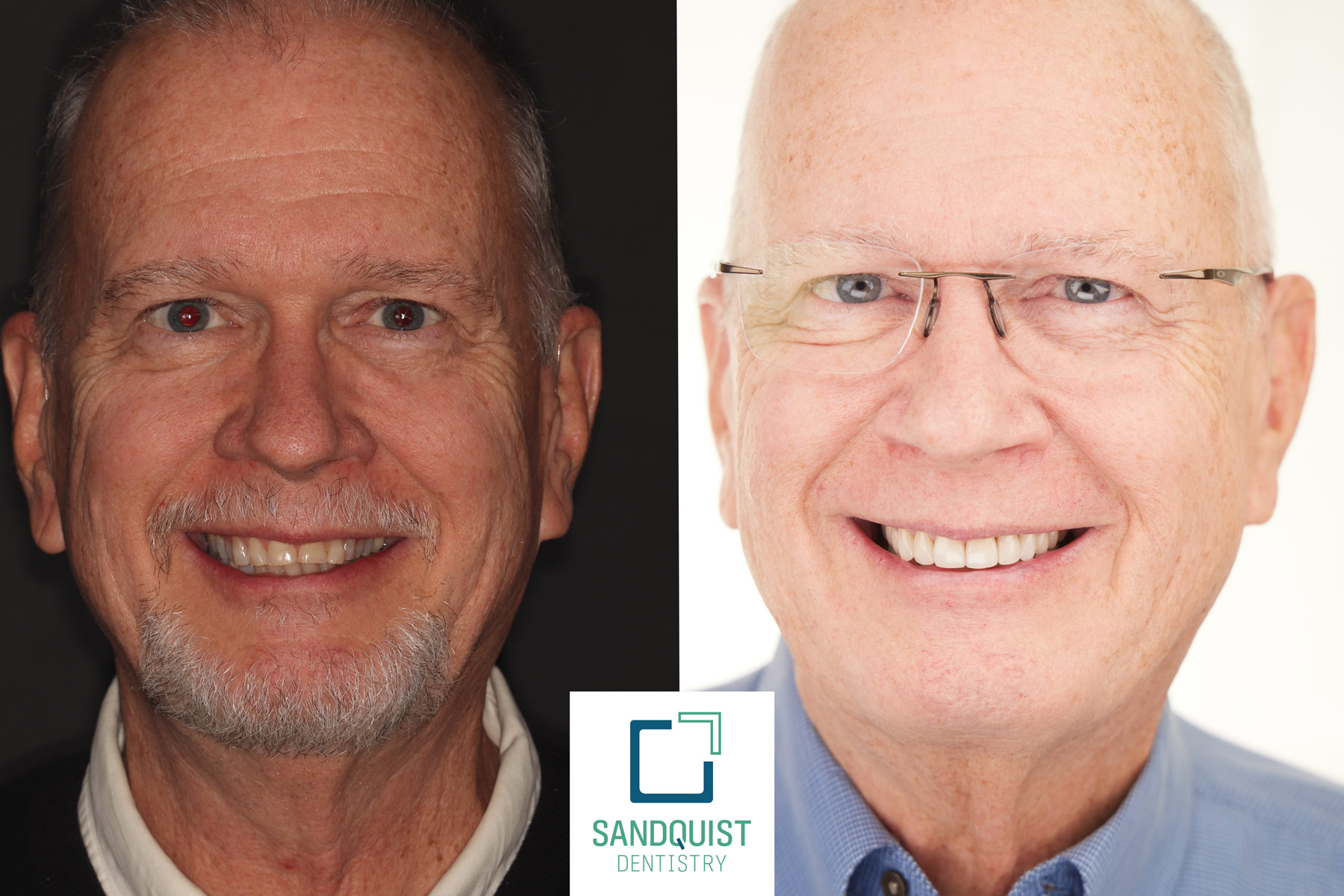 Smile Gallery - Sandquist Dentistry - Las Vegas Dentist